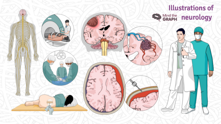 Neurological disorders: medical illustrations to understand