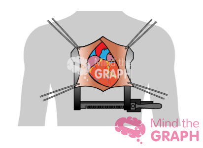 Types Of Open Heart Surgery