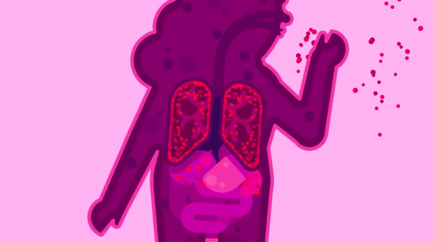 Coronavirus outbreak animated infographic - Mind the Graph blog