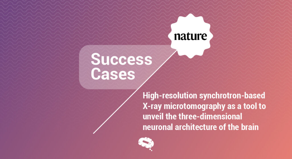 High-resolution synchrotron-based X-ray microtomography as a tool to ...