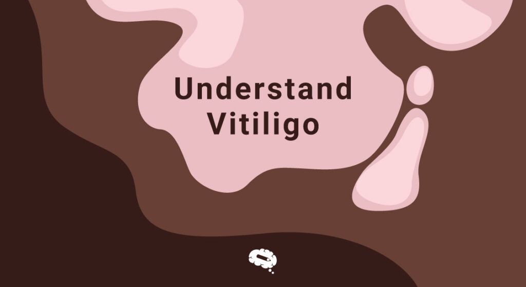 Understand Vitiligo: The Autoimmune Skin Condition Explained
