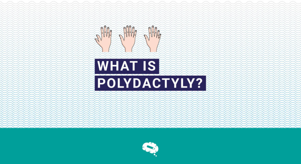 Polydactyly: Understanding the Condition